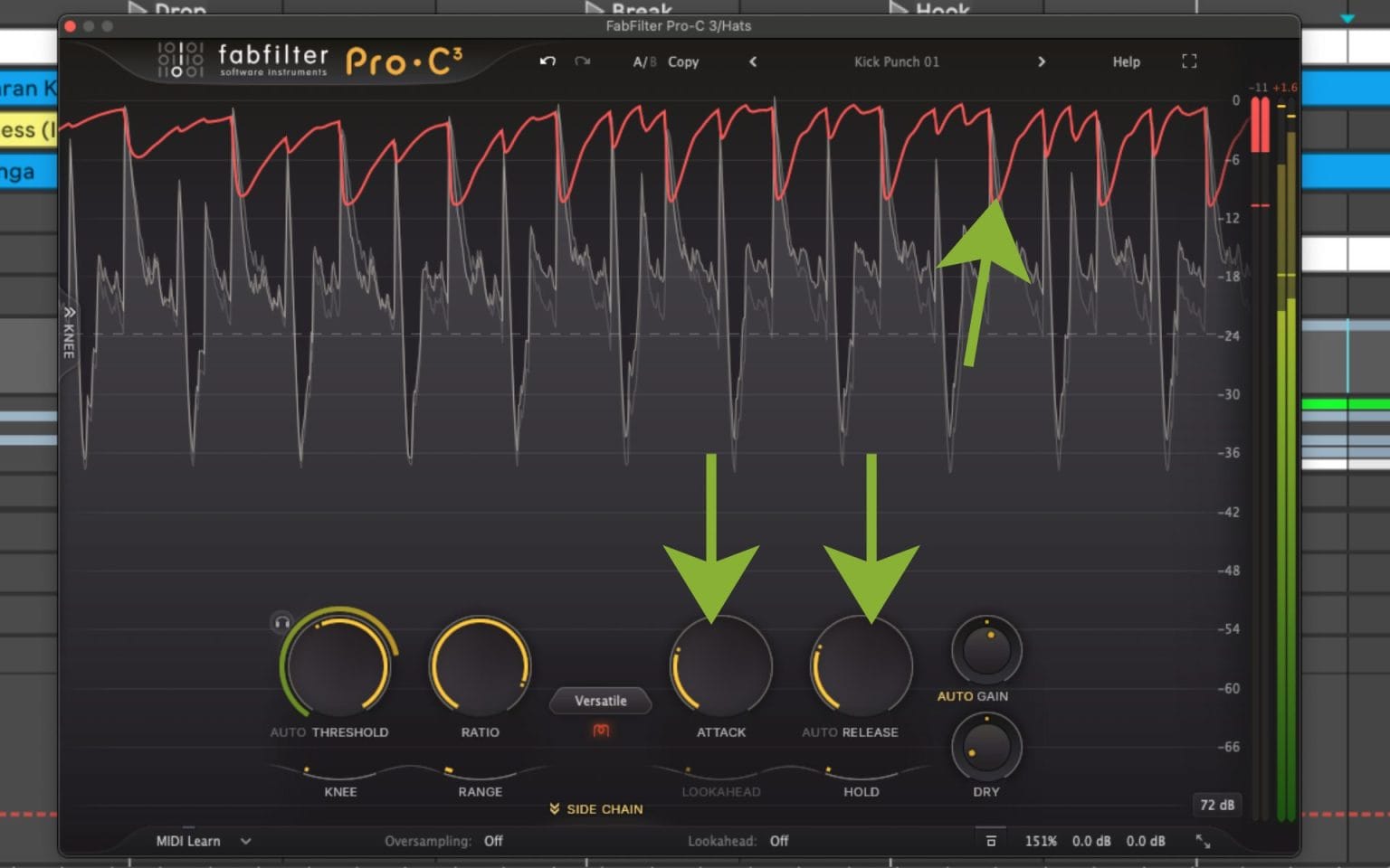 Audio Compressor Ratio Explained: How To Choose The Best Ratio Based on ...