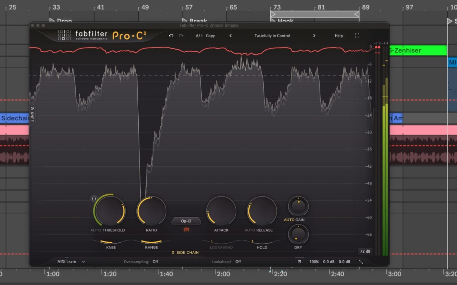 Audio Compressor Ratio Explained: How To Choose The Best Ratio Based on ...