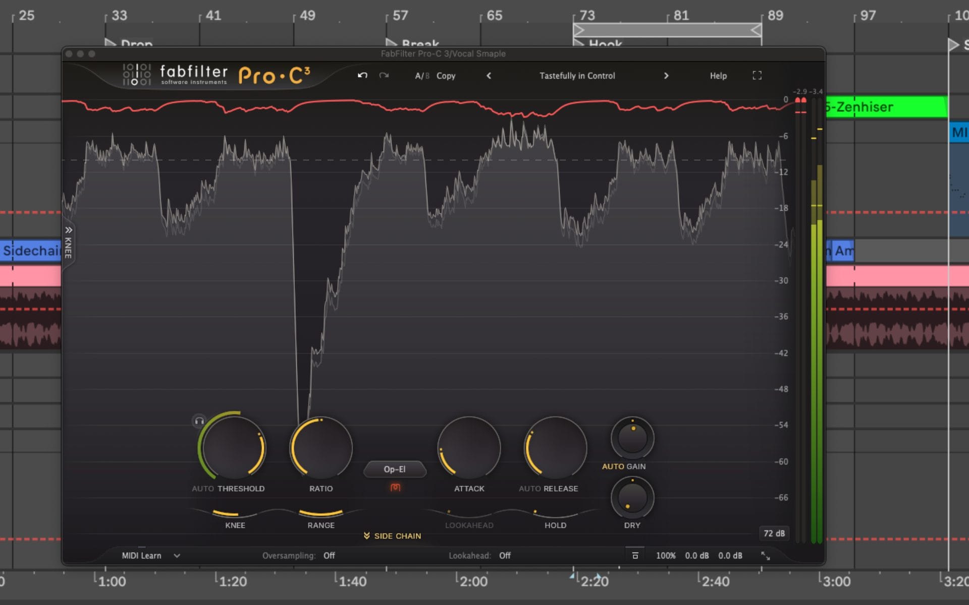Audio Compressor Ratio Explained: How To Choose The Best Ratio Based on ...