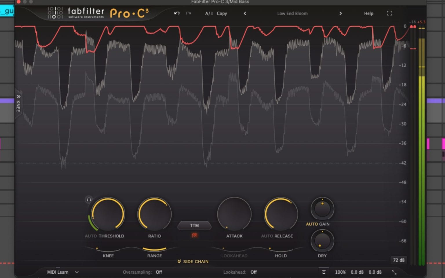 Audio Compressor Ratio Explained: How To Choose The Best Ratio Based on ...