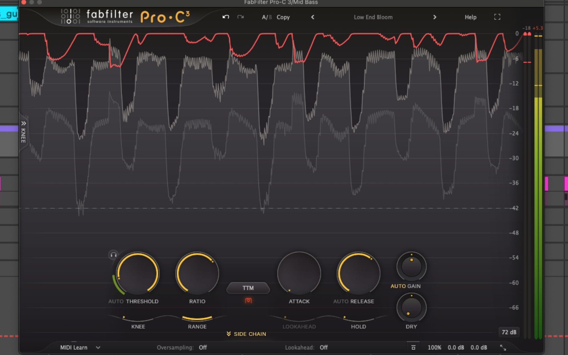 Audio Compressor Ratio Explained: How To Choose The Best Ratio Based on ...